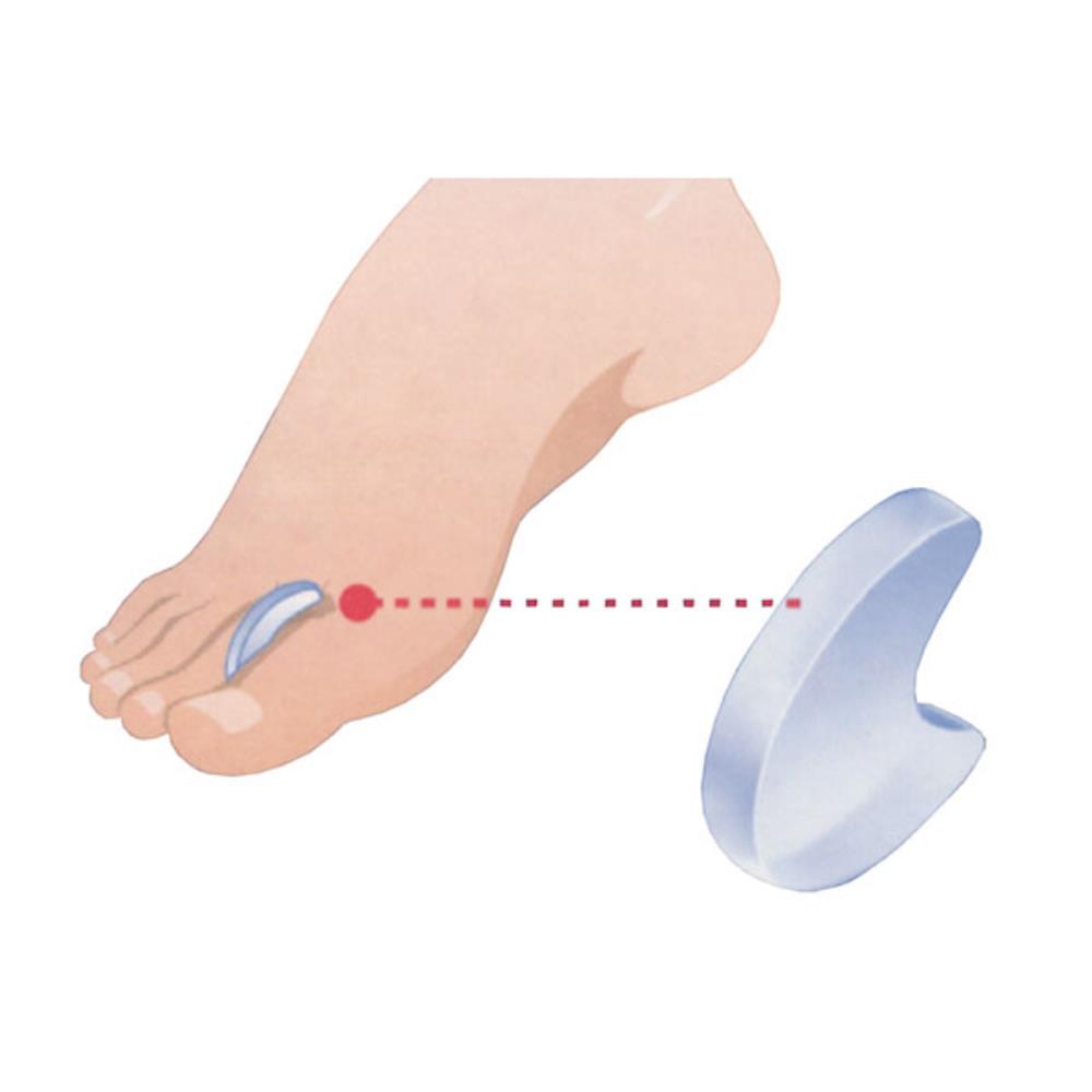 Toe Retractor Silicone – Whiteley AllCare