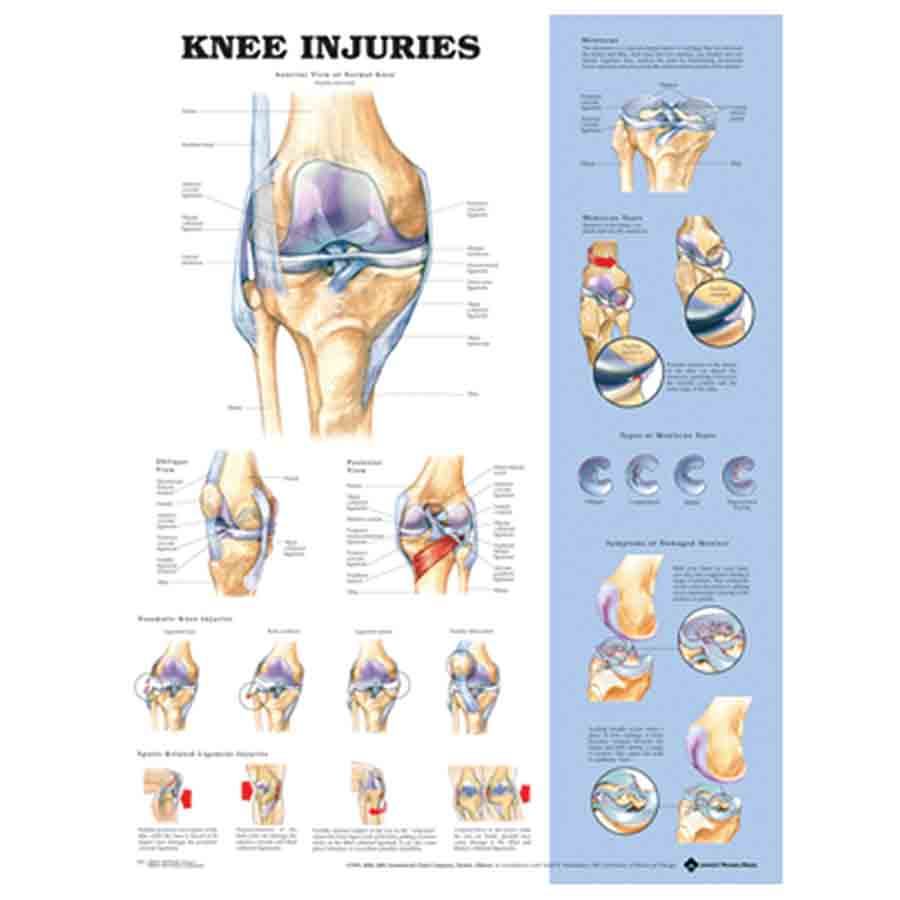 CHART KNEE INJURIES – Whiteley AllCare