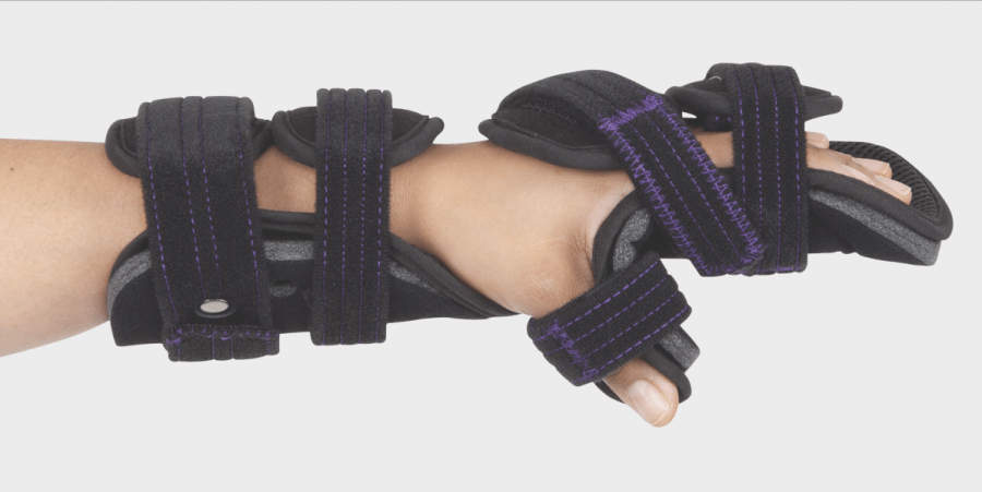 PROGRESS ULTRA-ORTHO SPLINT FOR PROGRESSIVE REPOSITIONING OF THE HAND,